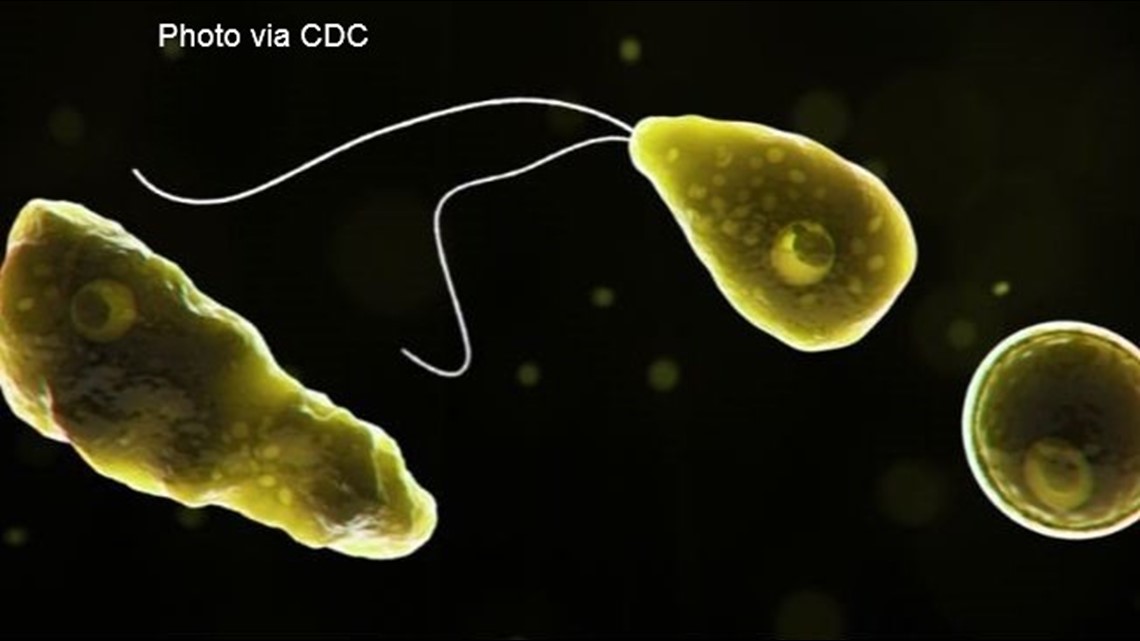 Q & A: Here's what you need to know about 'brain-eating amoeba ...