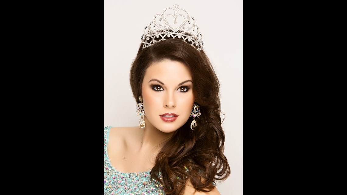 Jamie Blanek shares recovery after crash led to leg amputation | kcentv.com