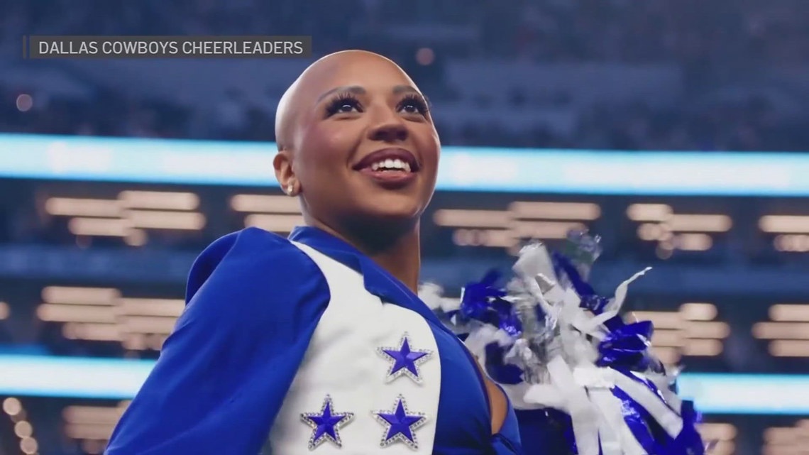 Cowboys cheerleader with alopecia cheers without wig for My Cause My ...