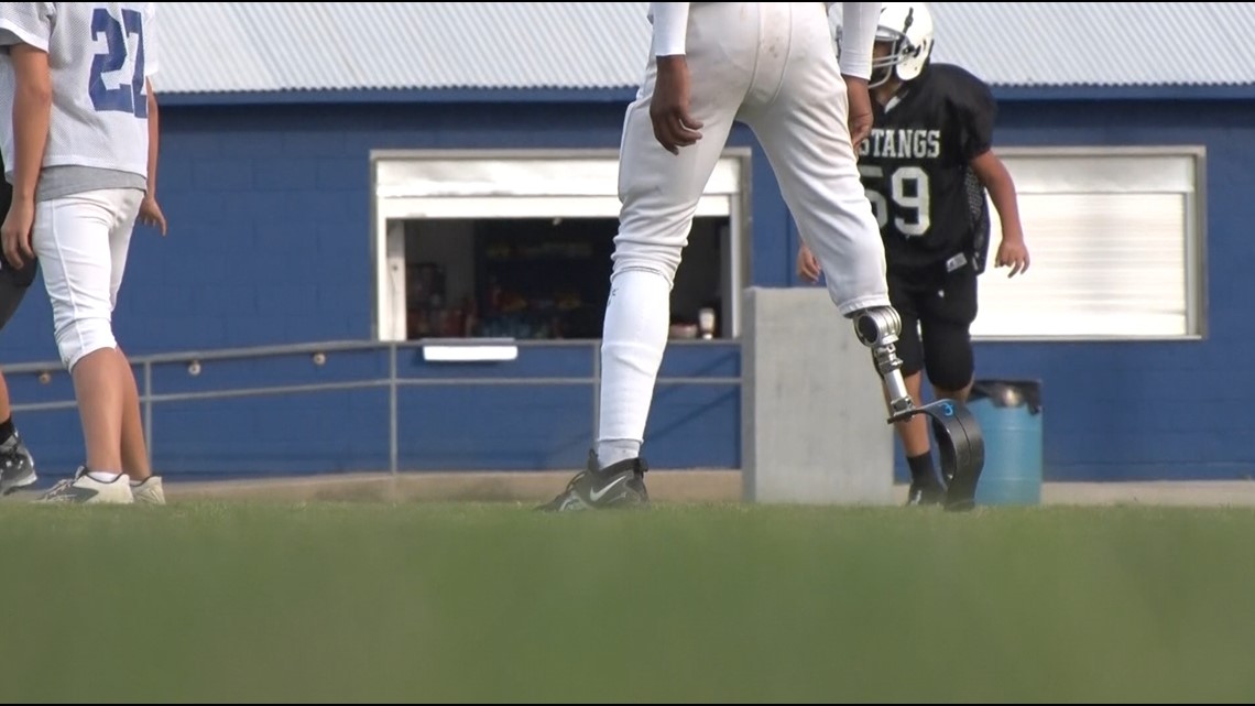 Midway student plays football with prosthetic leg | kcentv.com