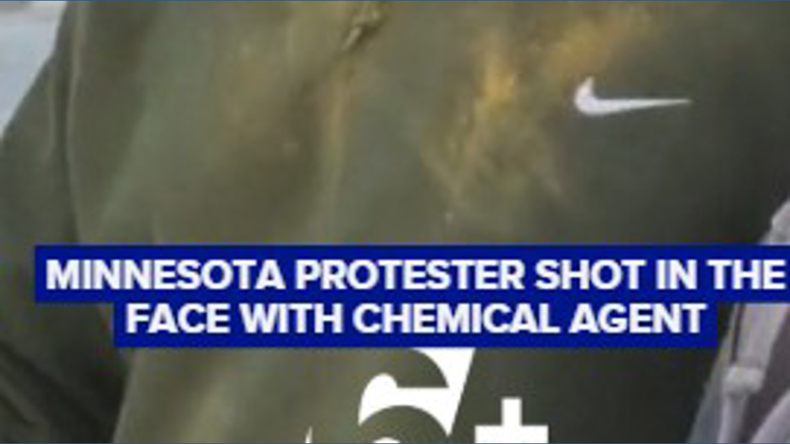 Video has surfaced showing an officer shooting a protester in the face ...