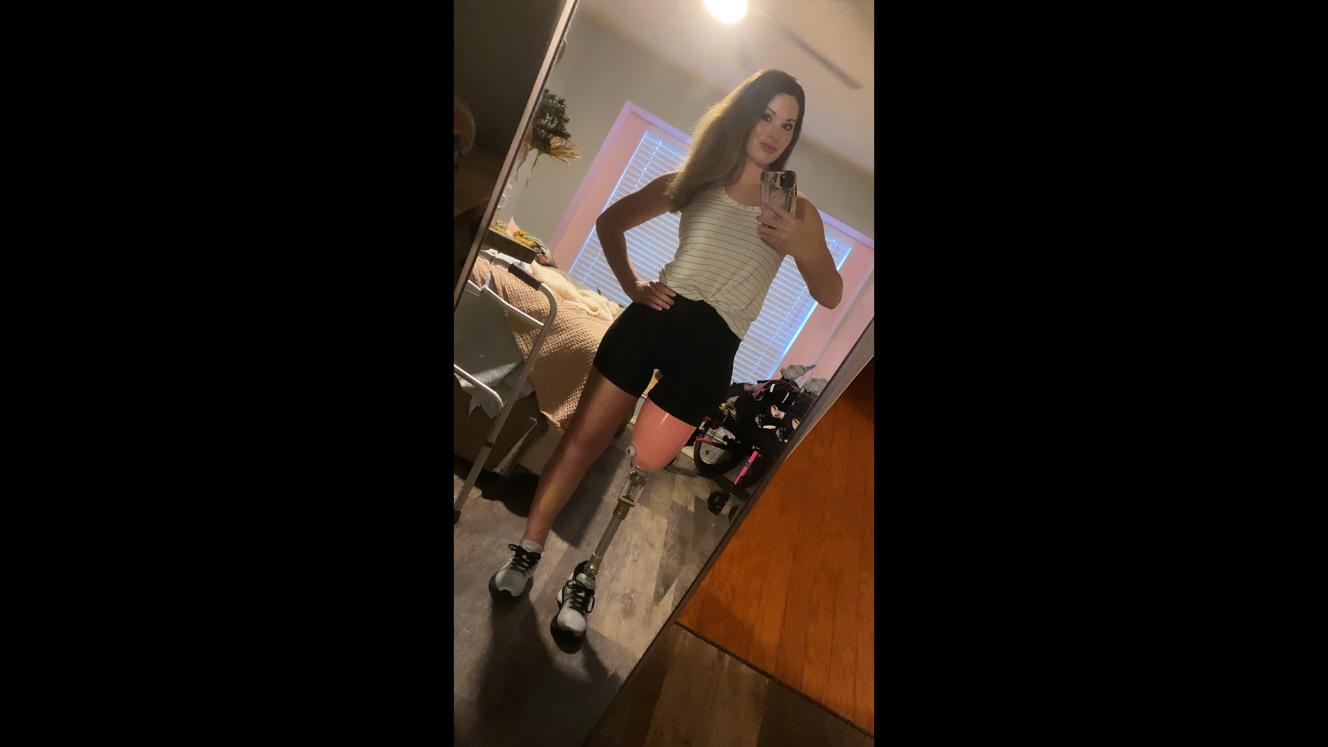 Jamie Blanek shares recovery after crash led to leg amputation | kcentv.com