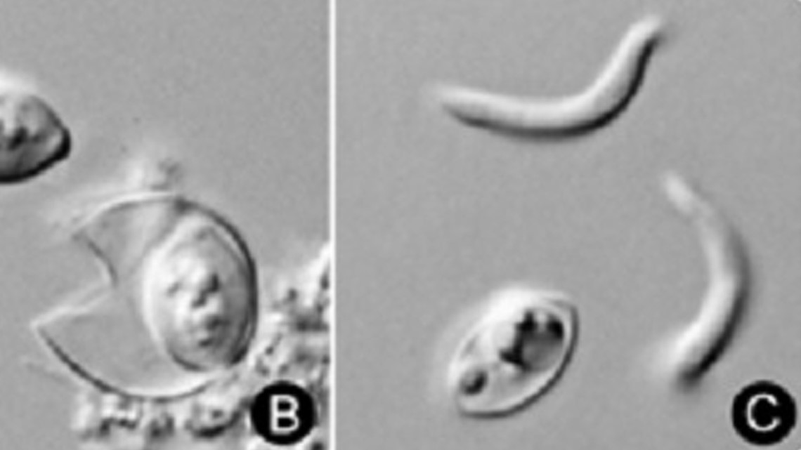 What are the symptoms of Cyclosporiasis? Parasite infects dozens in ...
