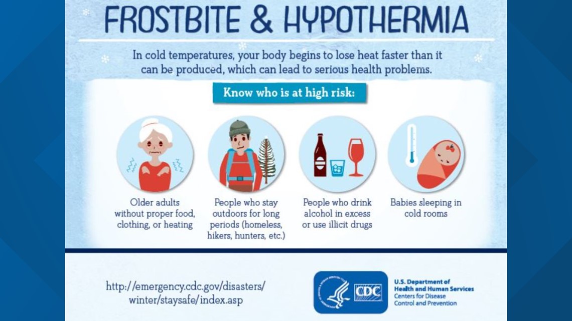 Preventing frostbite and hypothermia | kcentv.com